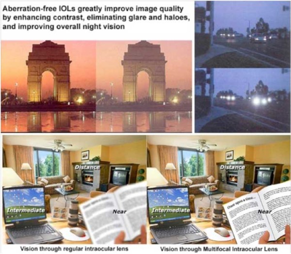 Types of Intraocular Lenses (IOLs) | Monofocal IOLs | Toric IOLs ...